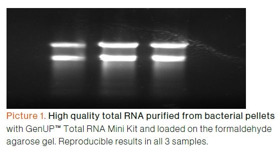 Biotechrabbit Genup™ Total Rna Kit Total Rna Isolation Nucleic